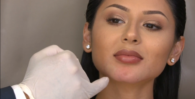 Celebrities With Weak Chins