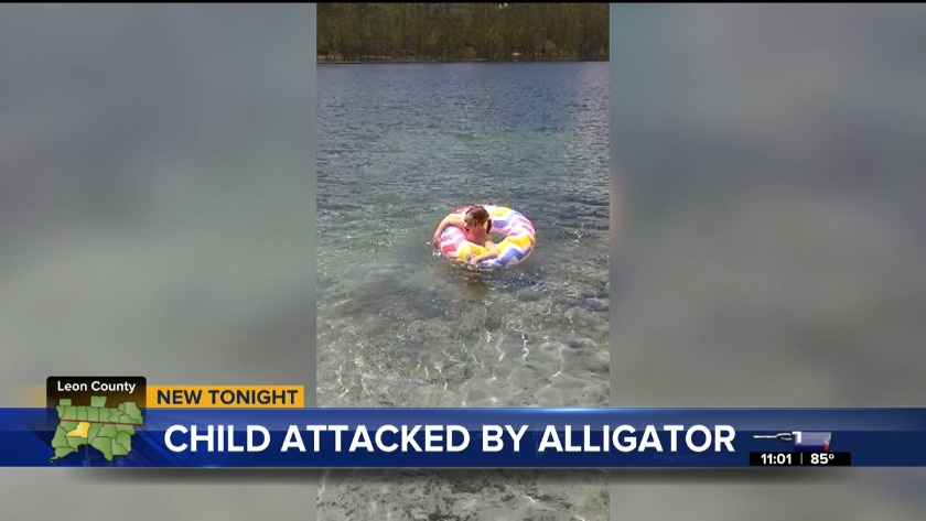 5-year-old recovering after being bitten by alligator in Leon County