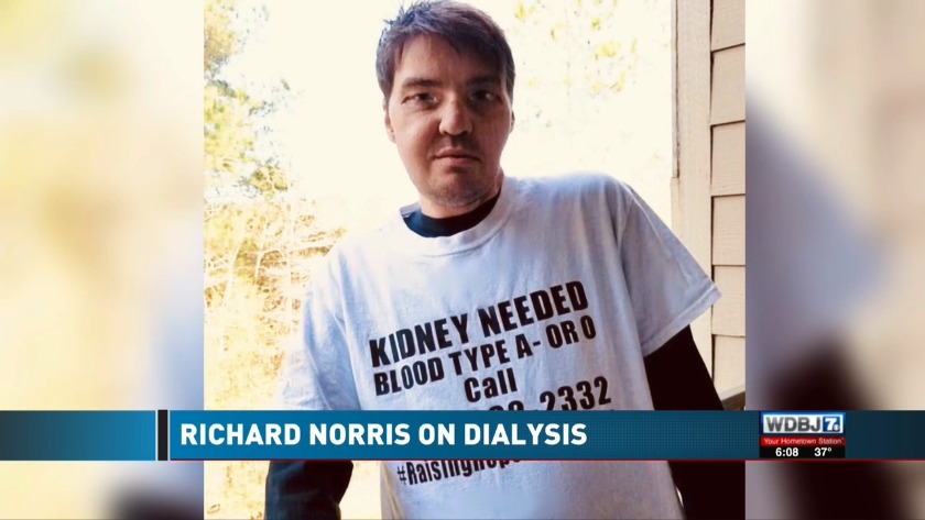 Doador Richard Norris Face Transplant Recipient To Go Under The Knife